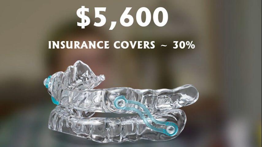 Red tape and high costs block sleep apnea patient's path to treatment ...