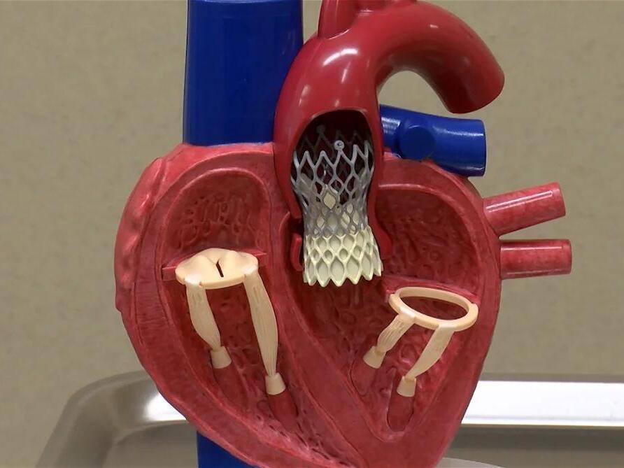 YRMC celebrates 10th anniversary of its lifesaving TAVR procedure