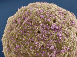 HIV PrEP Injections You Only Need Every 6 Months Are Being Trialed In ...