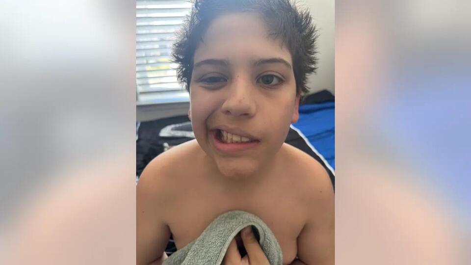 Virginia mom says son's face is partially paralyzed after being ...