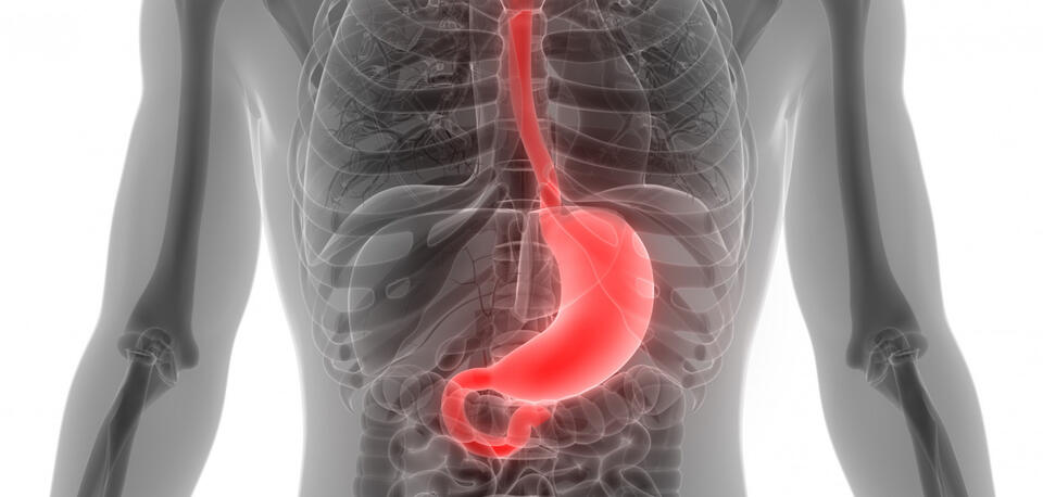 Turning Point in Stomach Cancer: Early-Stage Diagnoses Now More Common ...