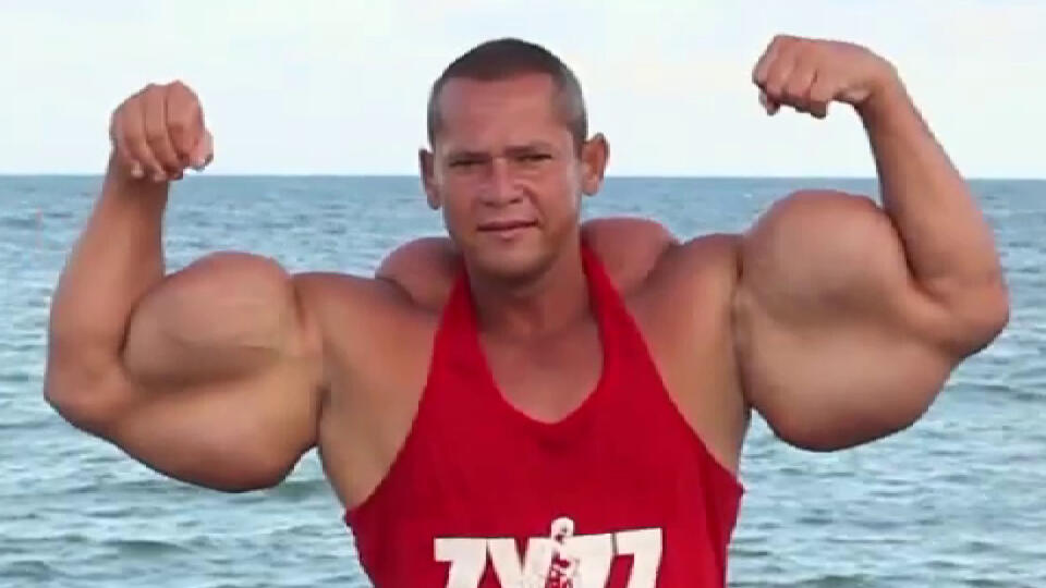 Bodybuilder Known for Using Oil and Alcohol Injections to Achieve ...