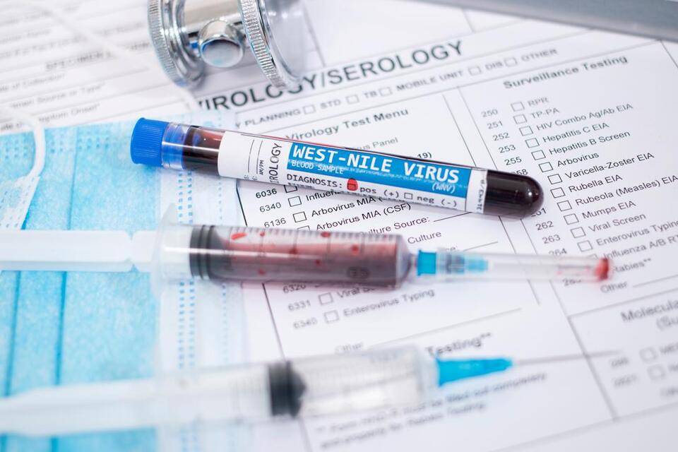 Fresno County records 1st West Nile virus death of 2025 - NewsBreak