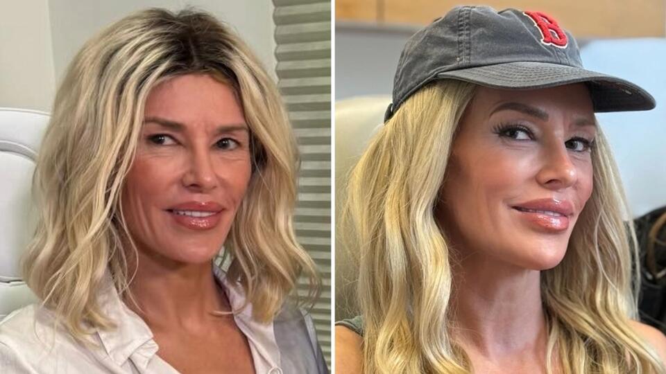‘RHOBH’ Alum Brandi Glanville Shows Off New Look, Thanks Plastic ...