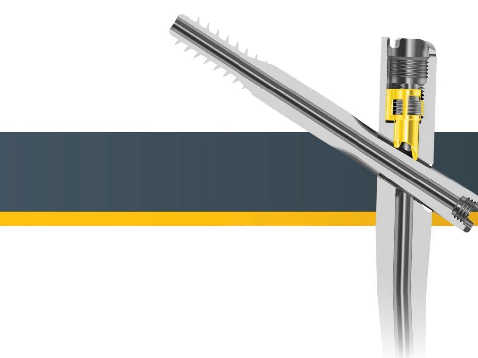 First European Surgeries Completed Using Stryker’s Gamma4 Hip Fracture ...